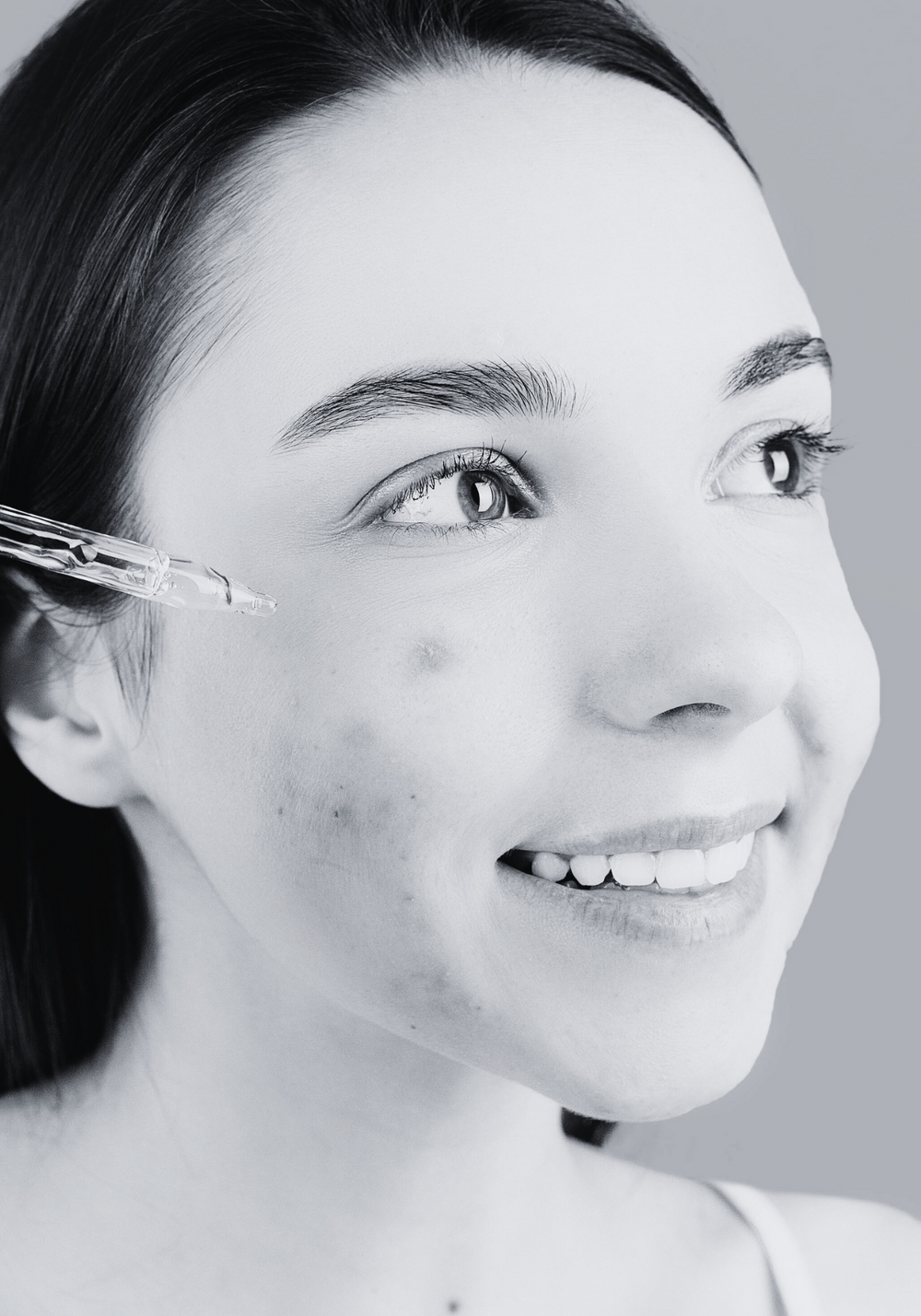 Improve Skin & Reduce Scarring With Acne Treatments | Agetoperfection.com