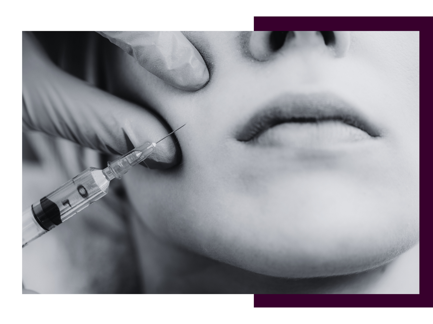 Droopy Jowls & Smile Lines Solutions | Agetoperfection.com